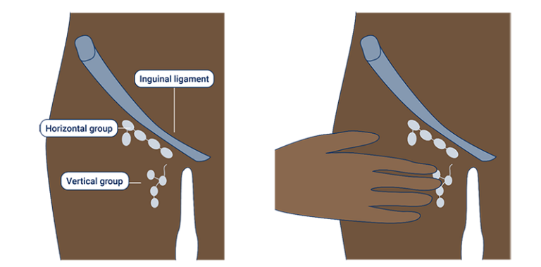 How to check your lymph nodes