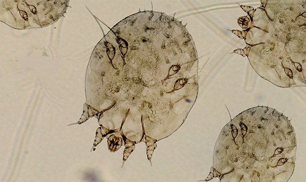 UK shortage of scabies medications is a snowballing public health issue ...
